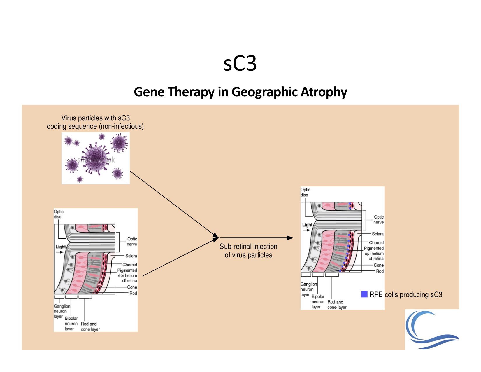 sC3 Gene Therapy Sub-Retinal Injections of Viral Particles - Cascade ...