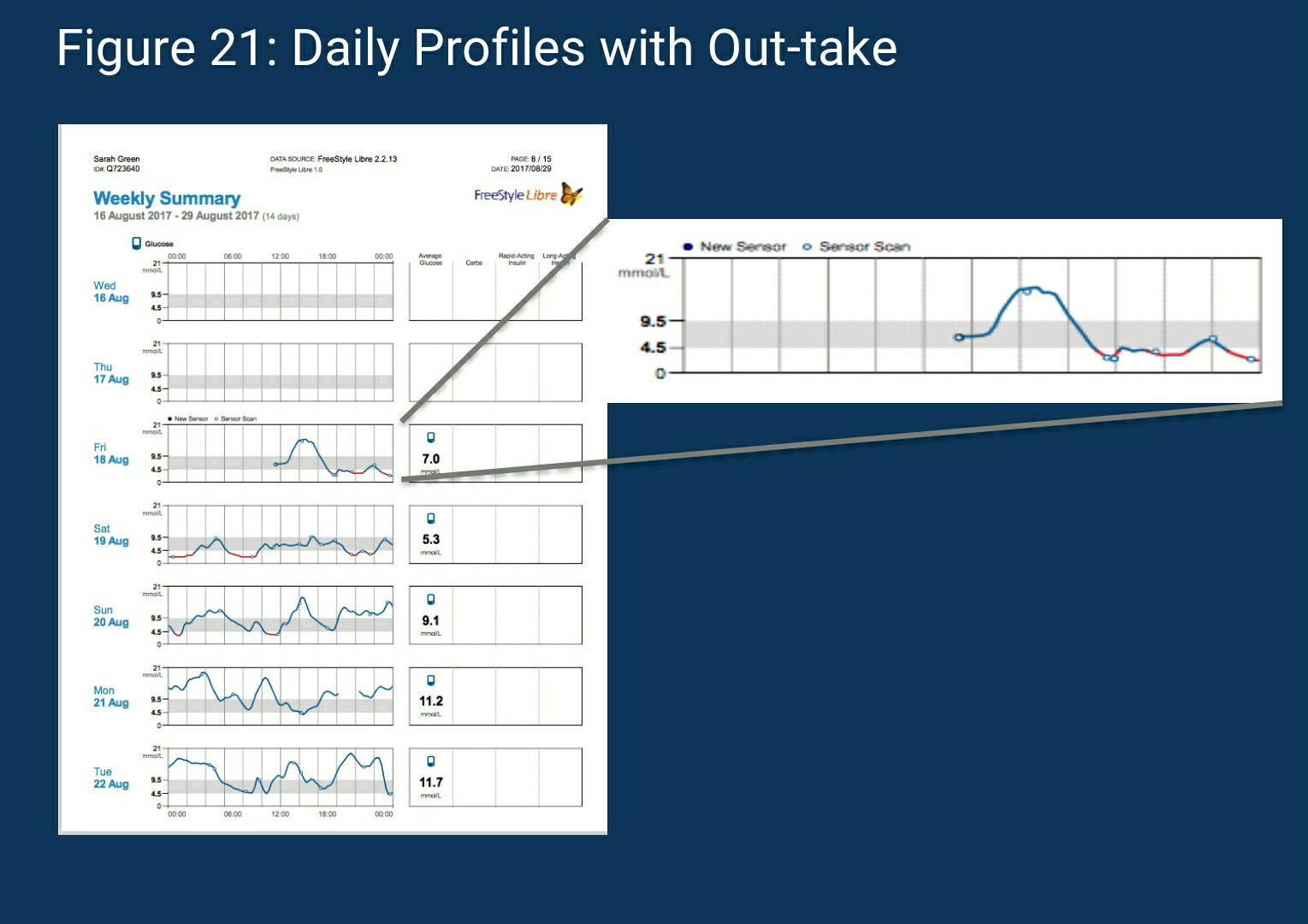 AGP|CGM|See more..to judge better